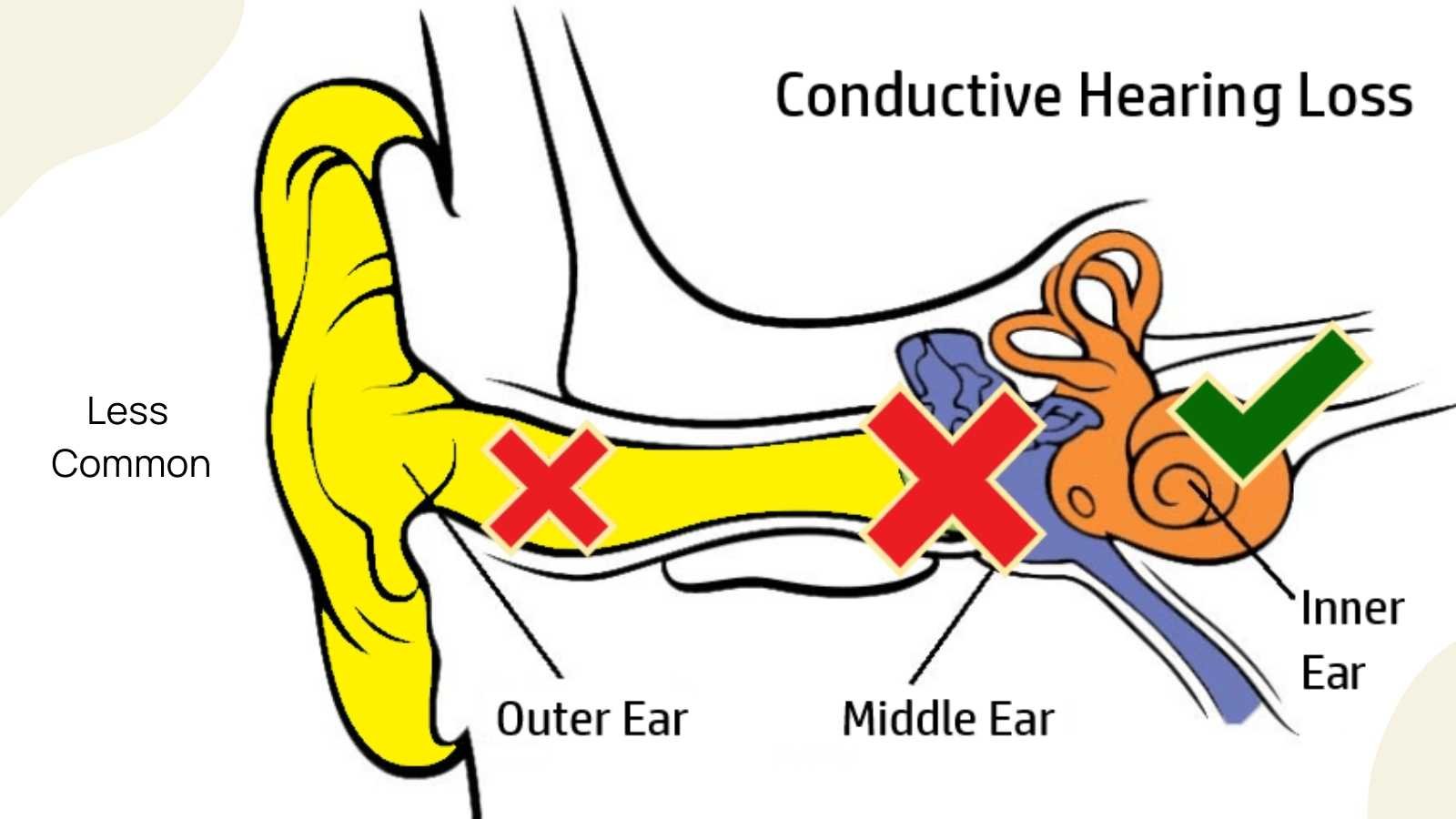  ALLTONE Hearing Solutions